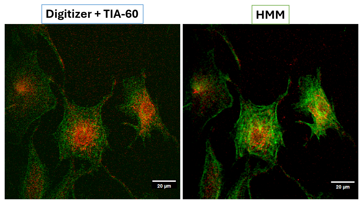 HMM-laser-scanning | triadlightinnovation